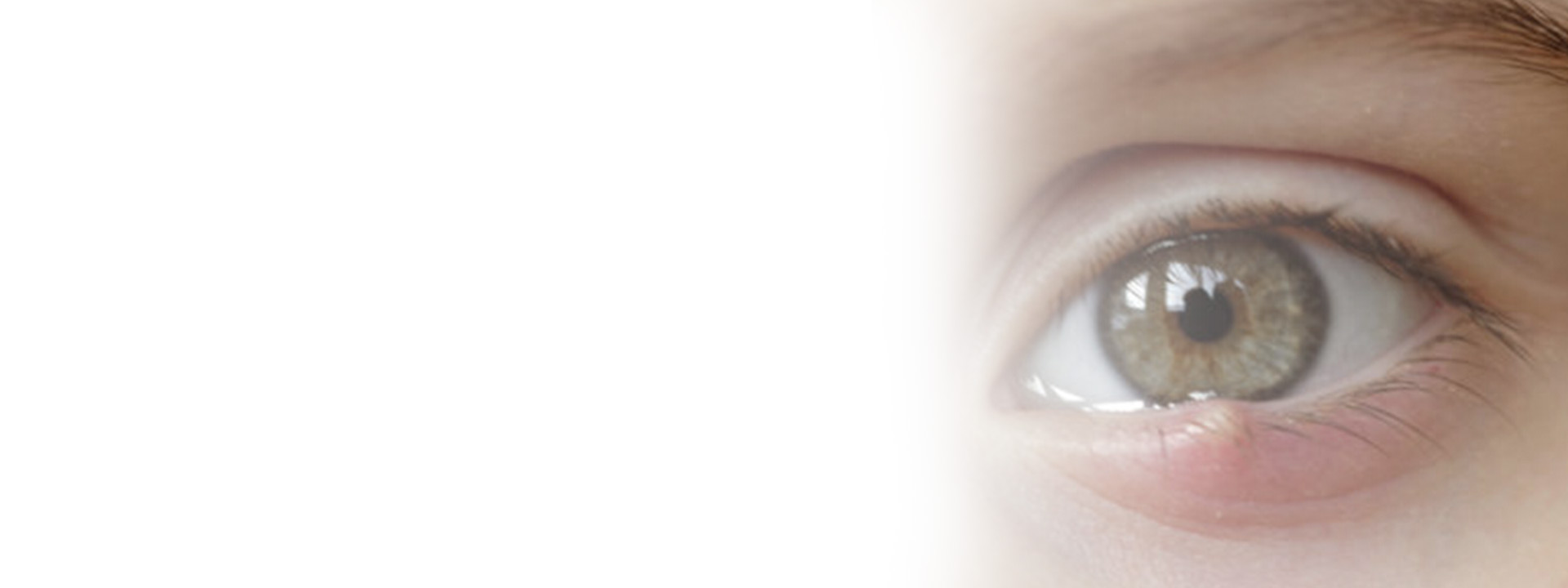 Šta je halacion? - Beogradski Oftalmološki Centar